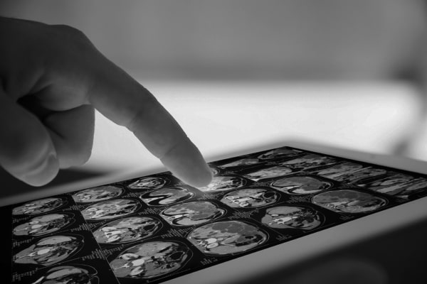 Digital Solutions for the Healthcare Industry | Softeq